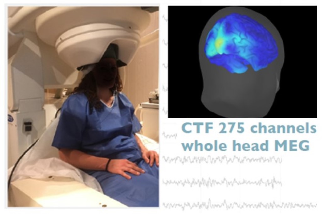 Platforms - NEUROSCIENCES